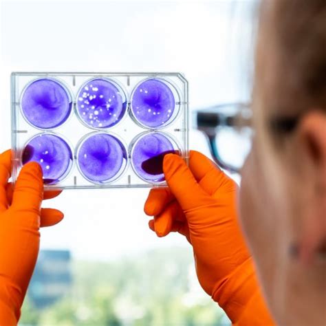 Analytical Assay Development Go All The Way Batavia