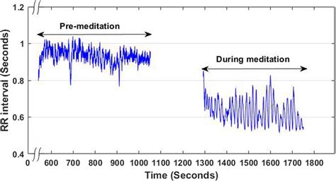 Hrv Signals Of A Representative Kundalini Yoga Meditator Y1 Before