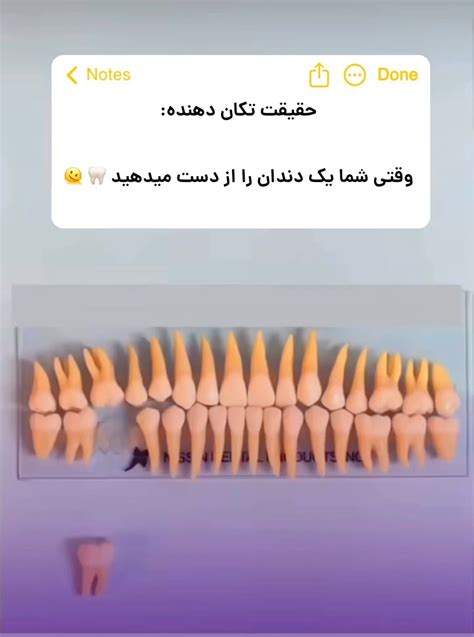 ‎ایمپلنت،کامپوزیت،لمینت،عصب کشی،جراحیکلینیک دندان پزشکی درسان