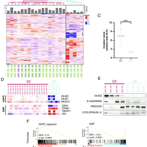 Transcriptomic Analysis Reveals 2 Types Of Diffuse Midline Glioma A