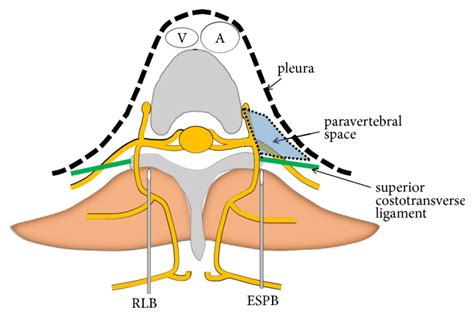 Paravertebral Space
