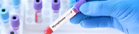 “efisiensi Penggunaan Real Ti Me Pcr Untuk Diagnosis Mycoplasma