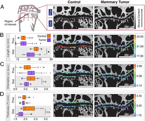 Metaphysis Of Tibia Semantic Scholar