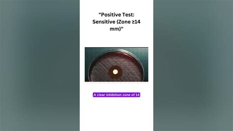 Optochin Test A Simple Way To Identify Pneumococcus Optochintest
