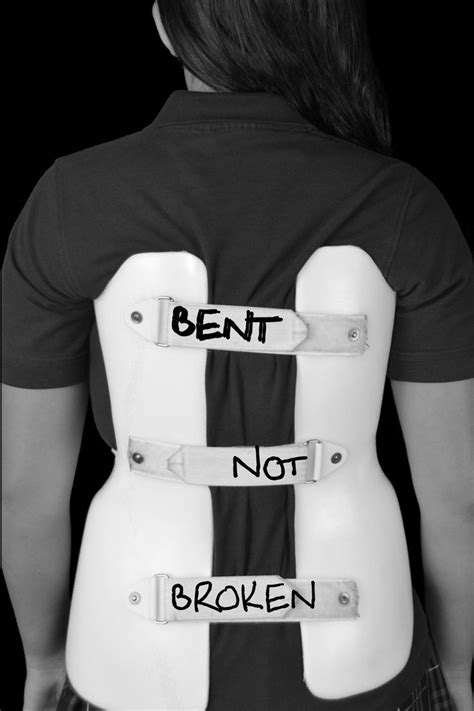 Understanding Scoliosis Braces Types Uses Effectiveness Round Shoulder
