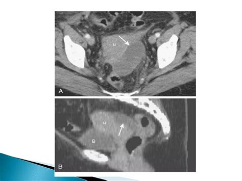 Imaging Anatomy Of Peritoneum Pptx
