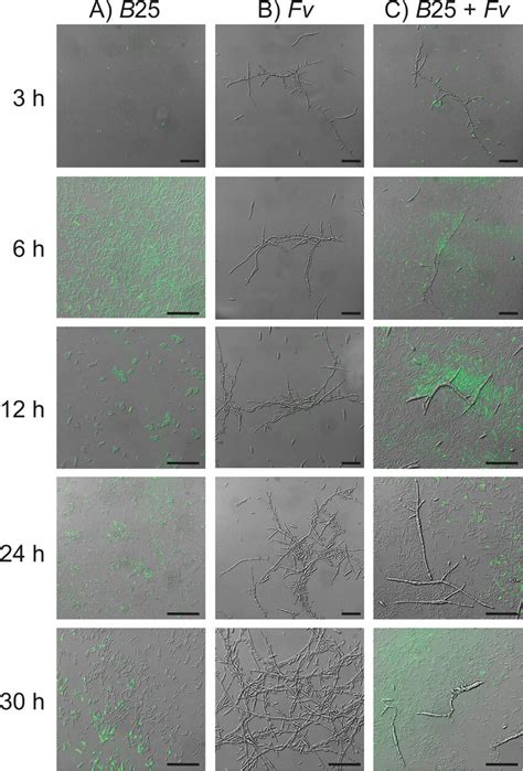 Microscopic Visualisation Of Samples From The Direct Confrontation