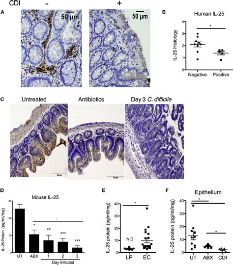 Il 25 Was Suppressed During Human And Murine Clostridium Difficile