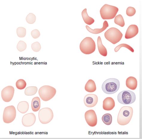 Citometria Hematica Quizlet