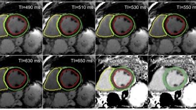 Radiology Artificial Intelligence On Twitter A DeepLearning