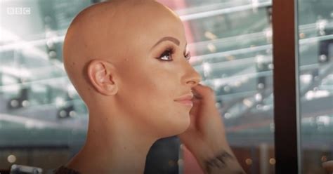 여성 탈모도 패션이다 英서 대머리 모델 캠페인 생겨나