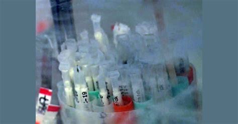 Redhead Sperm Bank Doesn T Want You