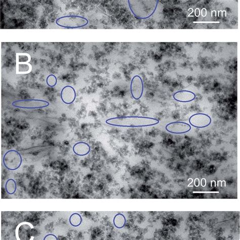 The Structure Of Cross Linked Polyethylene Formed From Chains With Each