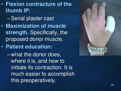 Burkhalters Procedure