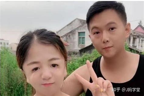 “鸟脸妈妈”不顾医生反对，生二胎后发现孩子像自己，全家叹气 知乎