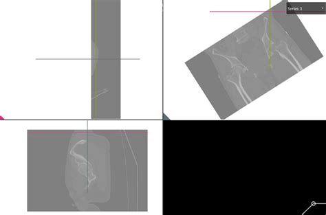 ForwardInteractor Issue 6 Termijn Dicom Viewer GitHub