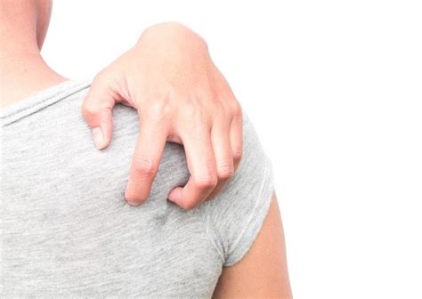 Infeksi Jamur Infeksi Tinea Gejala Obat Dll • Hello Sehat