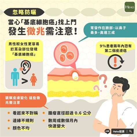 容易被忽略的「基底細胞癌」如何預防？皮膚出現 6 種變化要小心！ Heho健康 Line Today