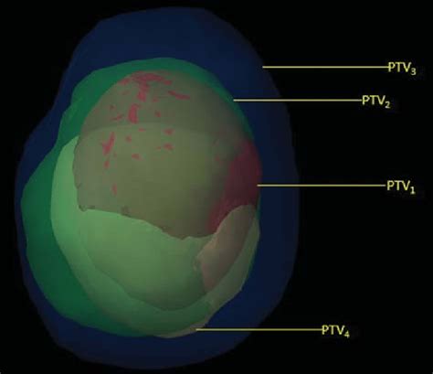 The Different PTVs PTV 1 Red 46 16 Cm 3 PTV 2 Green 83 98 Cm Download Scientific