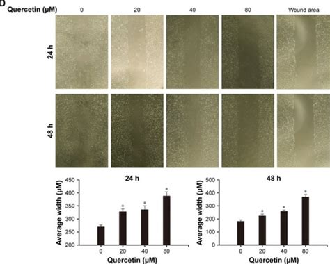 Full Article Quercetin Inhibits Epithelialmesenchymal Transition