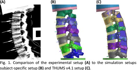 figure 1 from subject specific lumbar spine finite element model