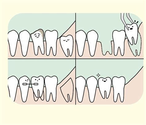 Premium Vector Remove A Teeth And Implant Another Teeth Flat Illustration