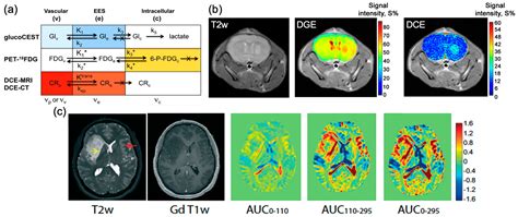 Molecular Imaging Of Brain Tumors And Drug Delivery Using Cest Mri Promises And Challenges