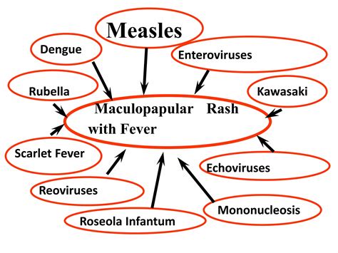 Fever With Rash Ppt