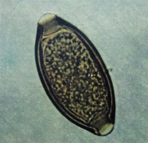 Tricocefalosis Trichuriosis Quizlet