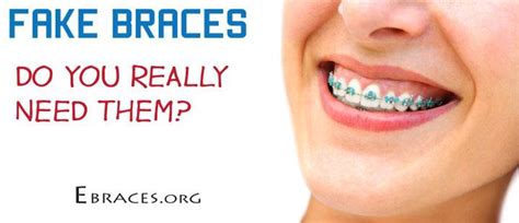 Do You Really Need Fake Braces