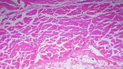 Stratified Squamous Epithelium In Section Filmed By Microscope 200x