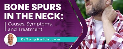 Bone Spurs In The Neck Causes Symptoms And Treatment