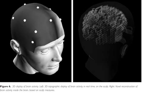 Openvibe An Open Source Software Platform To Design Test And Use Braincomputer Interfaces In