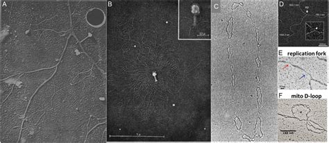 Electron Microscopic Dna Images A The First Em Image Of Dna In 1948 Download Scientific