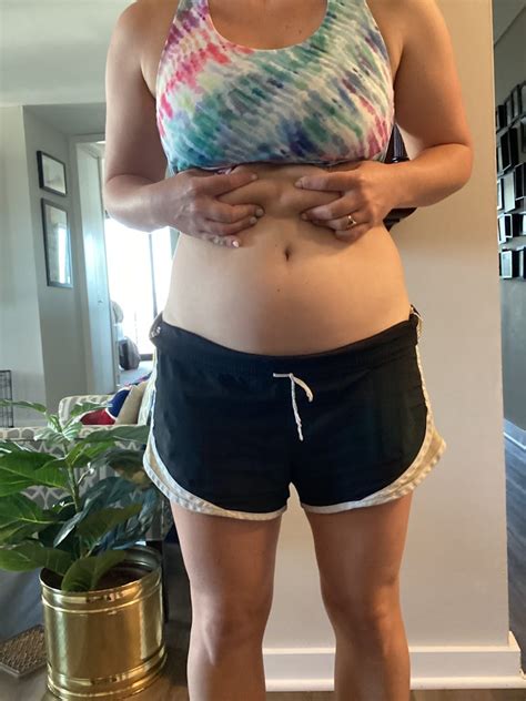 Patient 276015 Semaglutide Before And After Photos Images Med Spa
