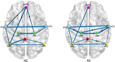 Bayesian Network Models Of Dmn Based On Grey Matter Volume Variations