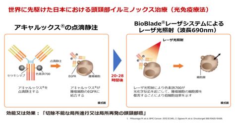 楽天メディカル、 「世界に先駆けた日本における頭頸部イルミノックス治療（光免疫療法）の実用化」について技術経営・イノベ ニコニコニュース