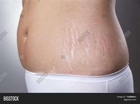 Female Belly Pregnancy Image And Photo Free Trial Bigstock