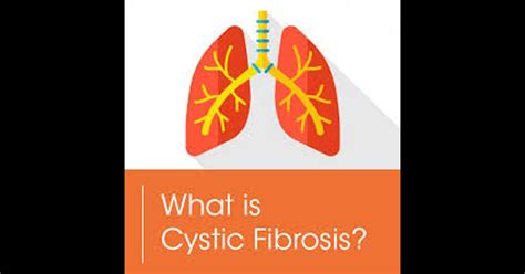 Pechakucha Presentation Cystic Fibrosis