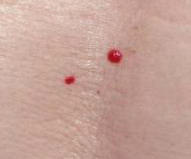 Skin Flashcards Quizlet