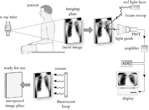 Procedure X Ray X Ray Imaging Test Quickly Helps Diagnosis