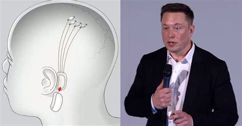 Elon Musk Wants To Implant Chips Into Our Brains Tech