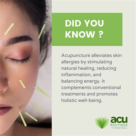 Acupuncture For Skin Allergies Facts Acu Boutique