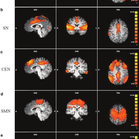 Resting State Networks Of 34 Participants Functional Connectivity Of