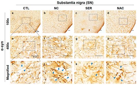 Immunohistochemical Analysis Of Aggregated α Synuclein α Syn