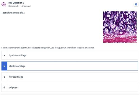 Solved Identify The Type Of CT Select An Answer And Chegg Com
