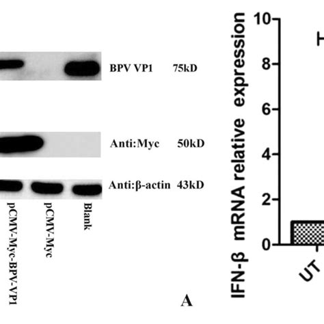The Recombinant Plasmid Of Pcmv Myc Bpv Vp1 Was Verified By Double