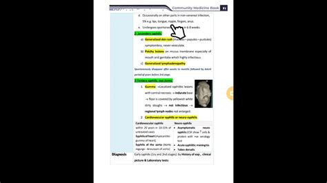 Sexually Transmitted Diseases Youtube