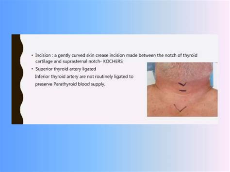 Multi Nodular Goitre Mbbs 3rd Year Pptx