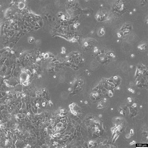 Ht 1376 Cells